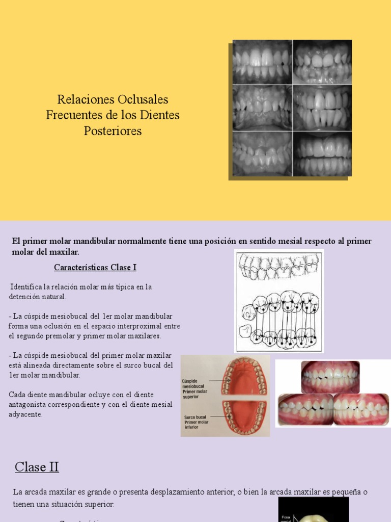 Relaciones Oclusales de Dientes Posteriores | PDF | Diente | Anatomia ...