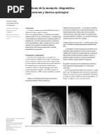 Fractura de Escápula: Diagnóstico y Tratamiento | PDF | Hombro ...