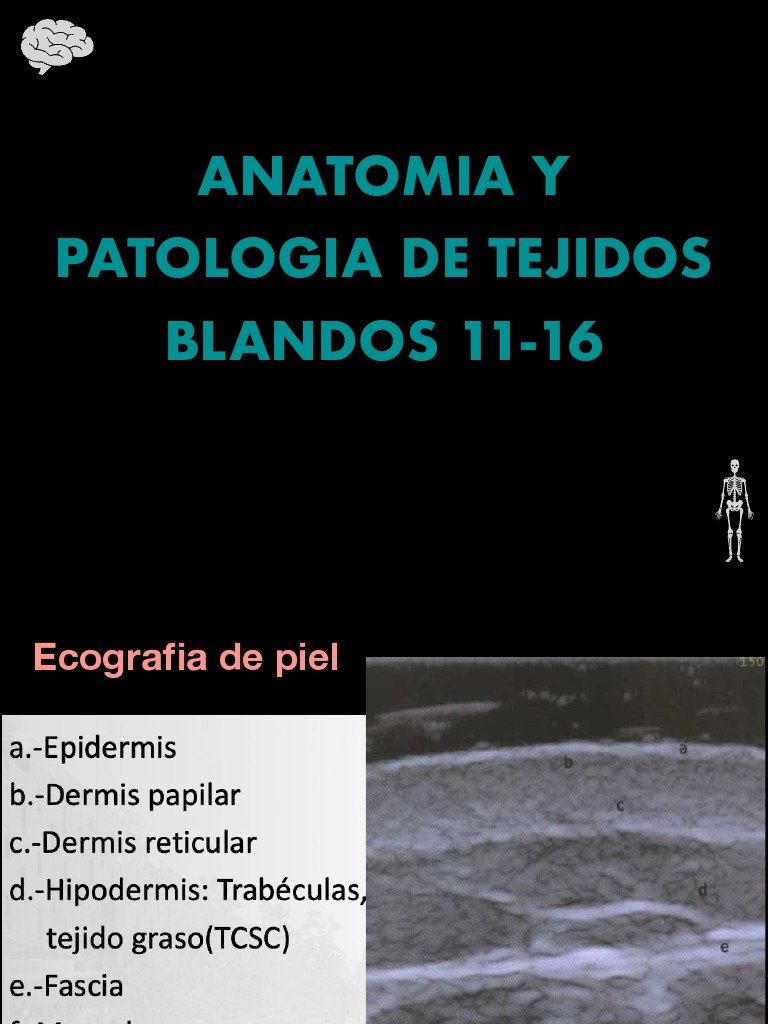 Tejidos Blandos Ecografia PDF | PDF