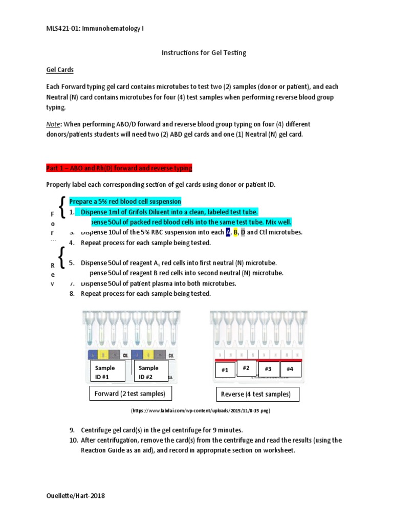 Instructions For Gel Testing: Sample ID #1 #1 #4 #3 #2 Sample ID #2 ...