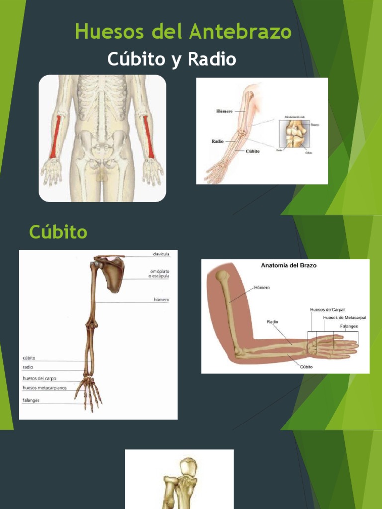 Cubito y Radio Exposicion | PDF