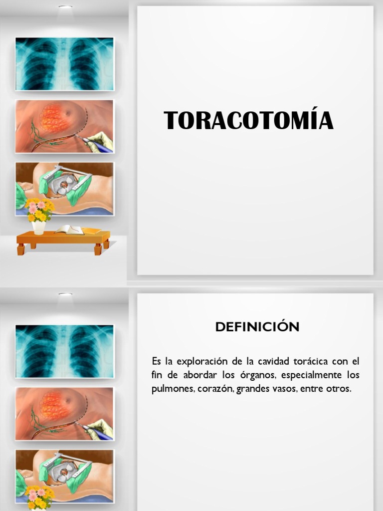 Guía detallada para la toracotomía: indicaciones, procedimiento ...