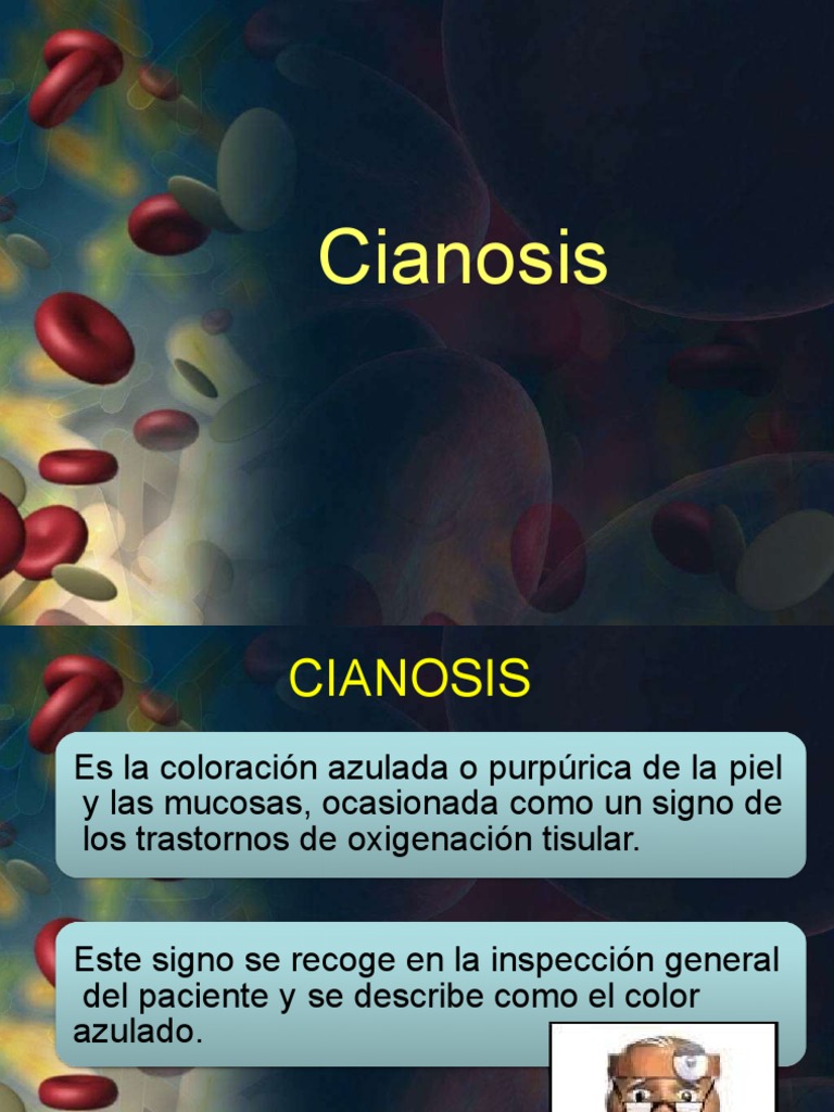 Cianosis: Tipos y Causas | PDF | Hemoglobina | Fisiologia Animal