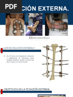 Placa Philos Técnica Cirúrgica | PDF | Tornillo | Cirugía