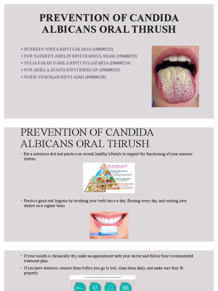 Prevention of Candida Albicans Oral Thrush | PDF | Candidiasis | Mouth