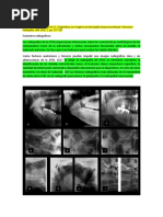 PROCEDIMIENTO PARA LA REALIZACI+ôN DEL EXAMEN DE RX DE SACRO COXIS ...