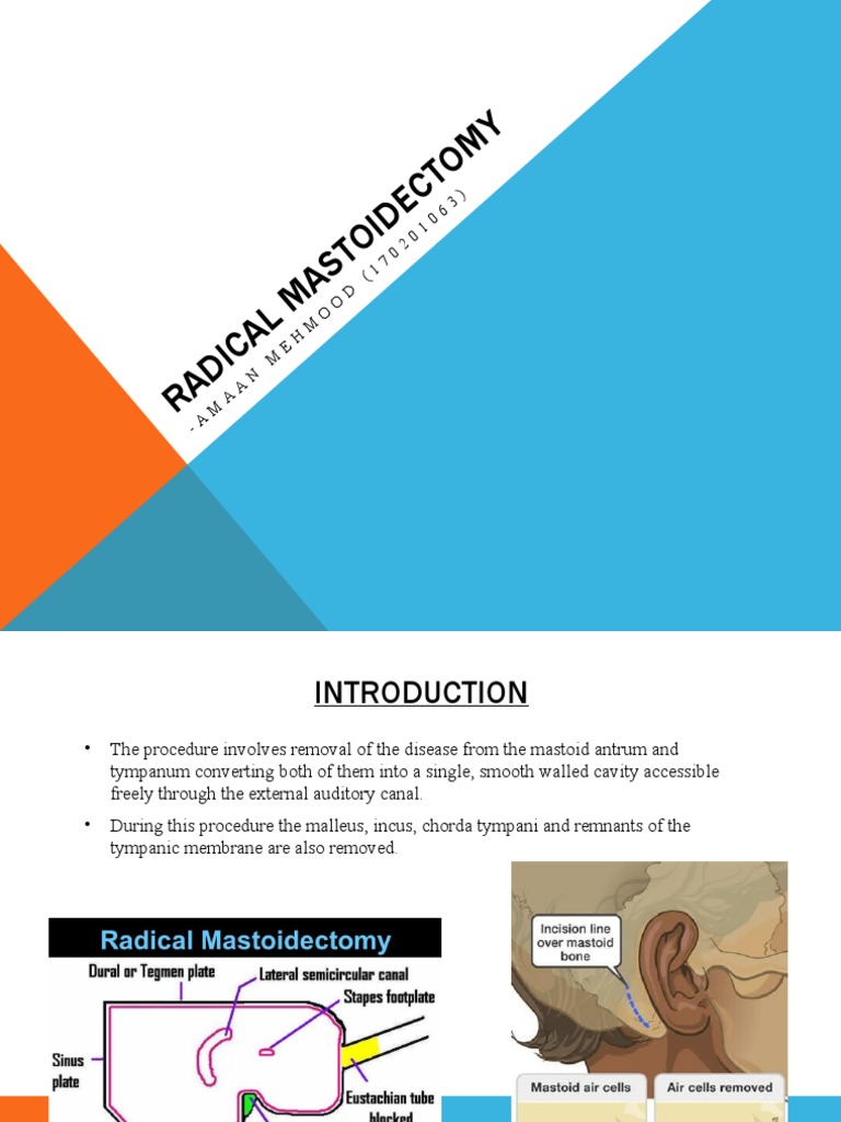Radical Mastoidectomy | PDF | Ear | Audiology