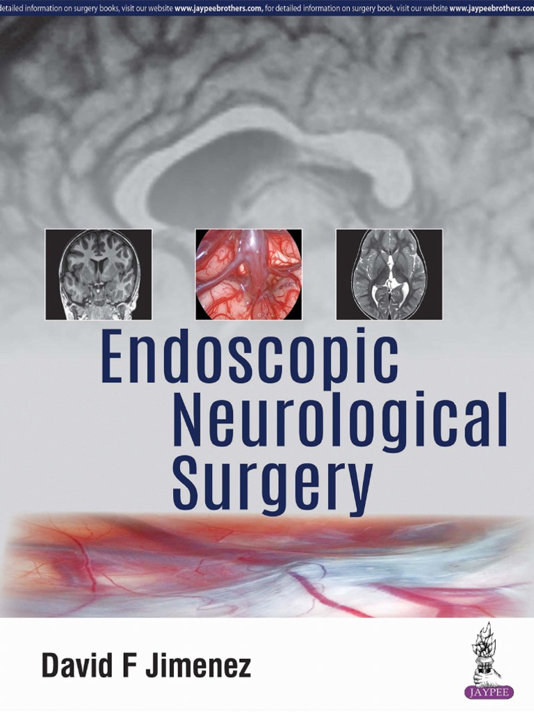 Endoscopic Neurological Surgery | PDF | Central Nervous System | Brain