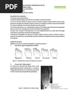 Pie Talo, Pie Varo, Valgo, y Pie Plano | PDF | Pie | Tobillo