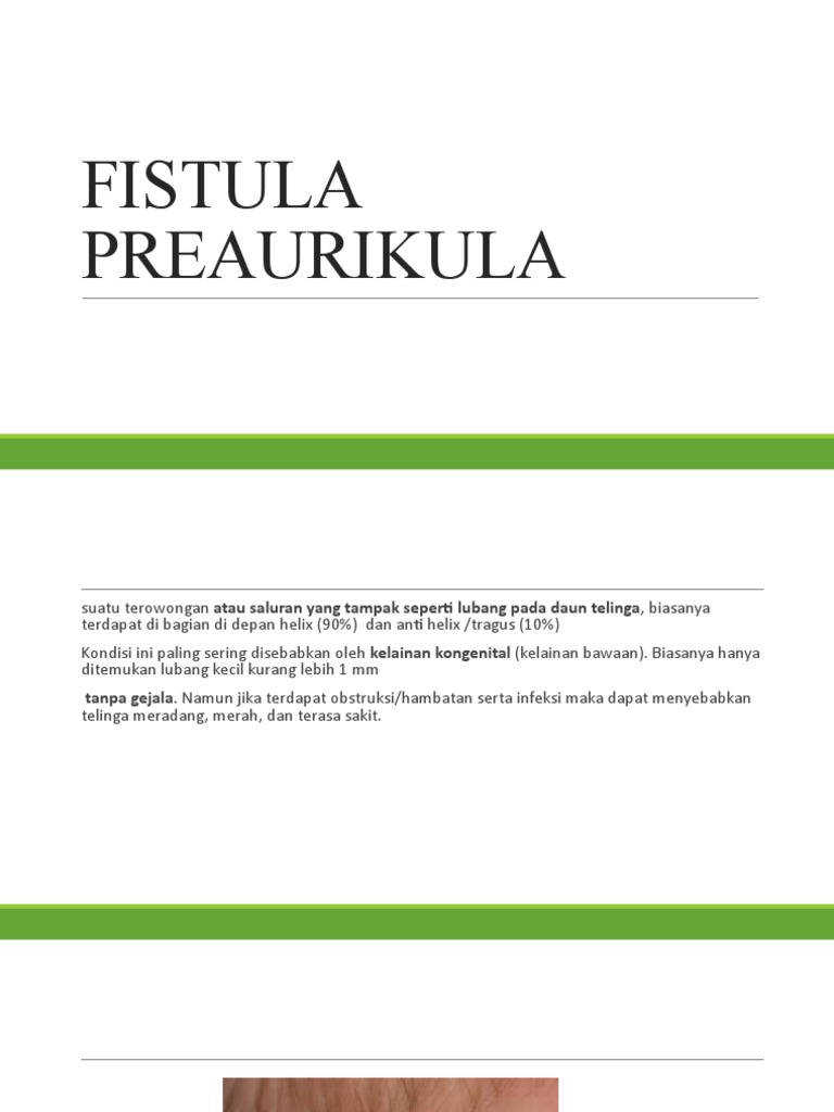 Fistula Preaurikular dan Inflammation Telinga | PDF | Pengembangan Diri ...