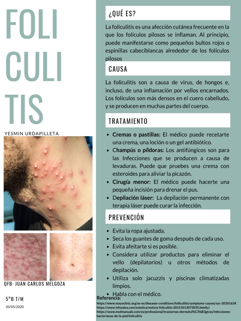 FOLICULITIS | PDF | Especialidades Medicas | Medicina CLINICA
