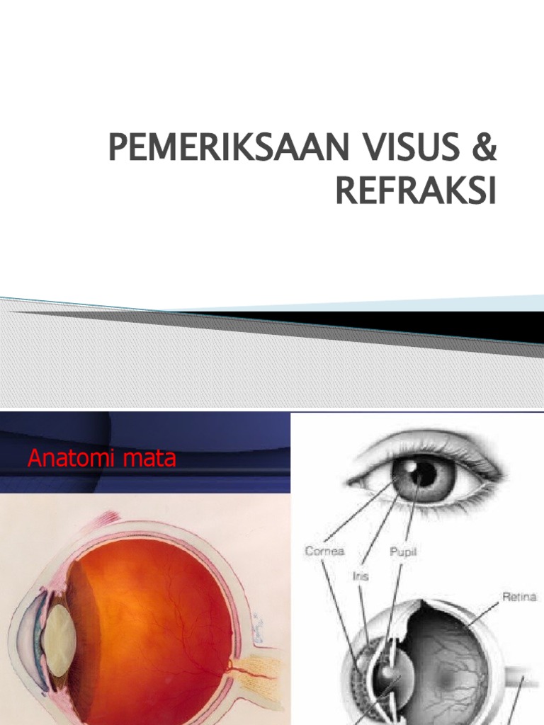 PEMERIKSAAN-VISUS-REFRAKSI (Kukuh) | PDF