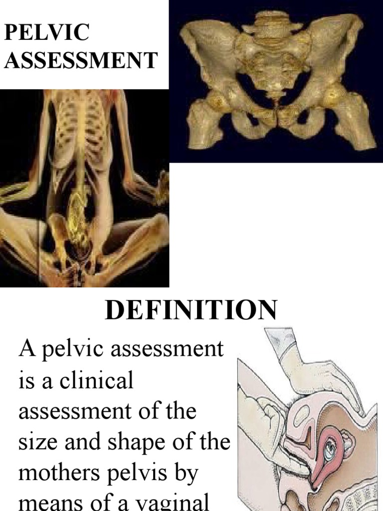 Pelvic Assessment Maternity Nursing | PDF
