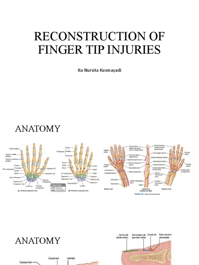 RECONSTRUCTION OF FINGER TIP INJURIES Final | PDF | Nail (Anatomy) | Thumb