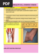 Mano de Predicador | PDF | Mano | Anatomía humana