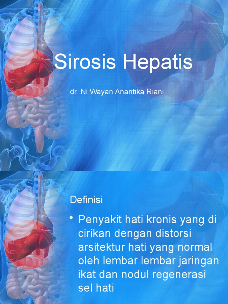 Sirosis Hepatis PPT | PDF