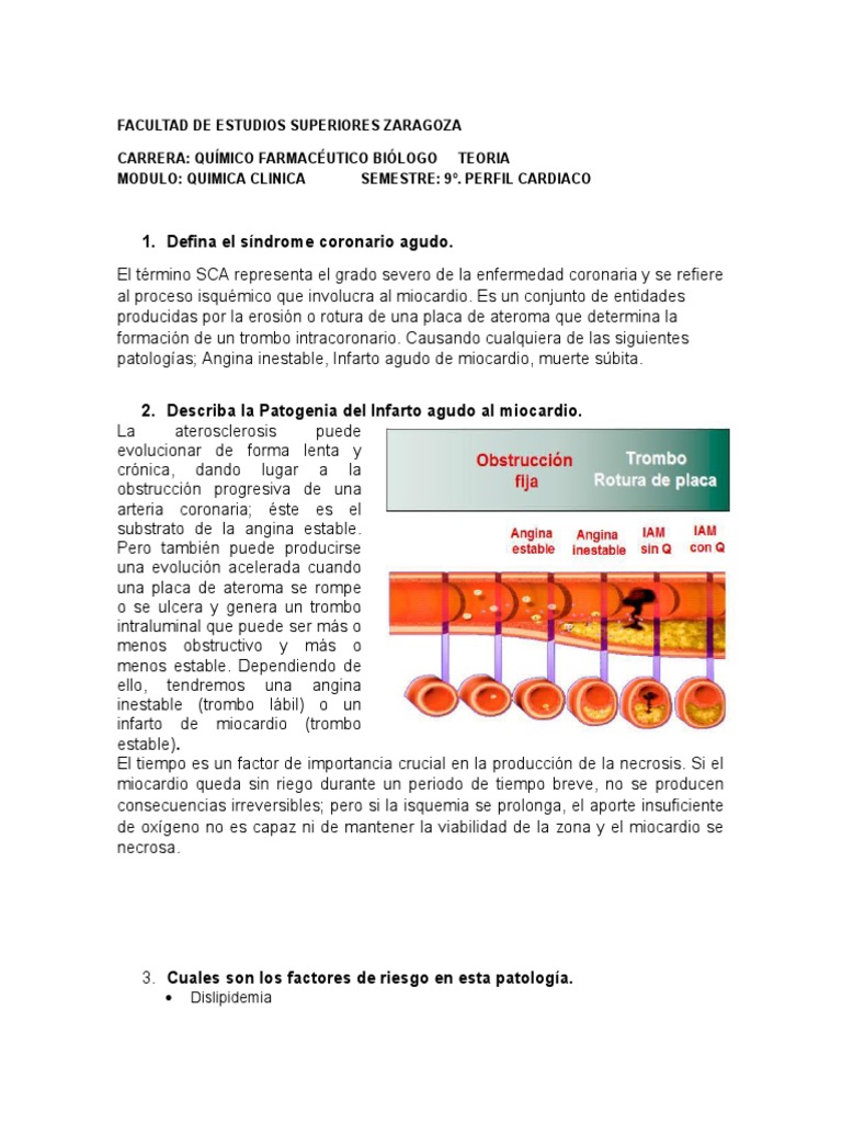 Perfil Cardiaco | PDF | Infarto de miocardio | Isquemia