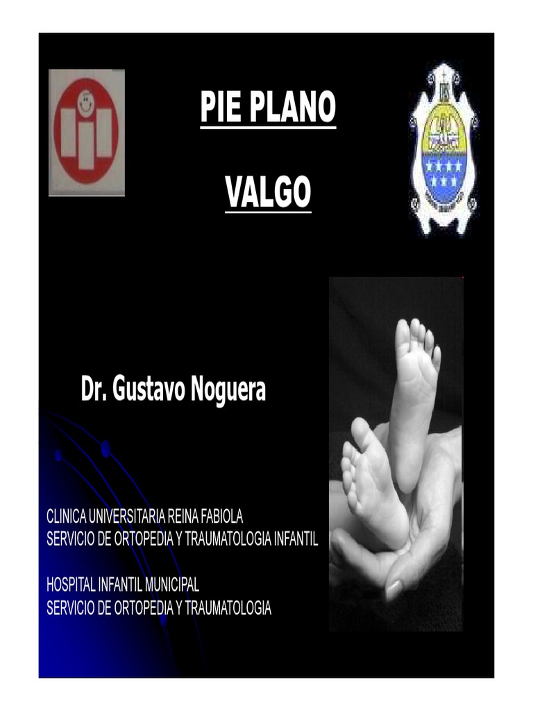 Diagnóstico y Tratamiento del Pie Plano Valgo | PDF | Pie ...