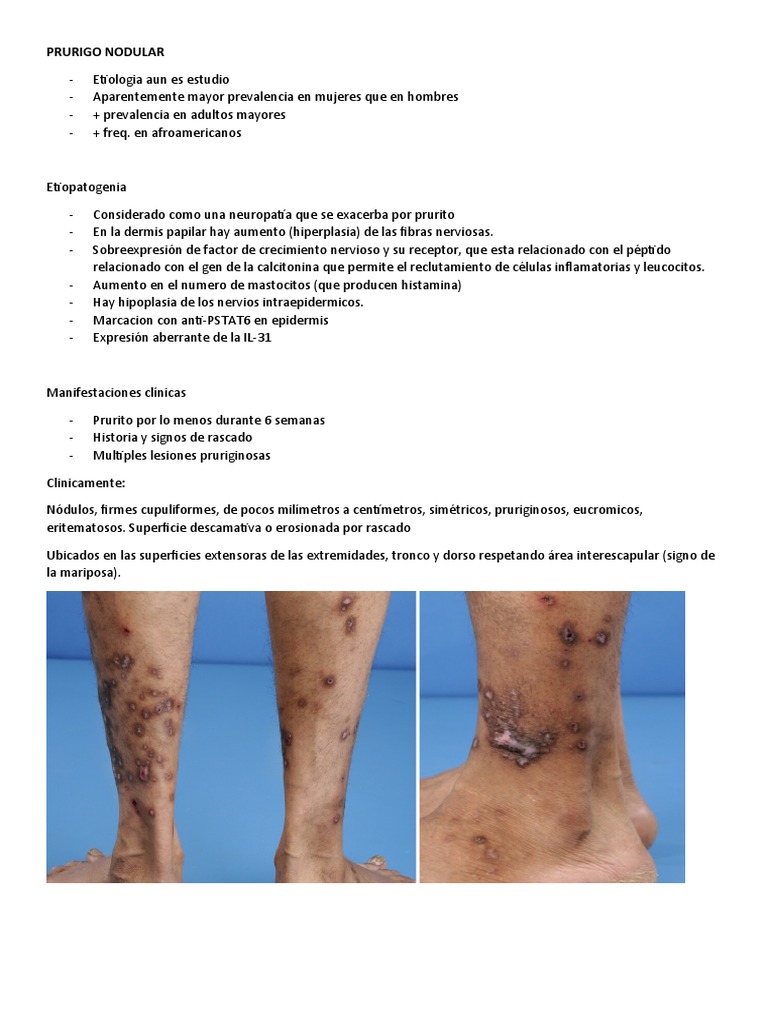 Prurigo Nodular (Resumen Mio) | PDF | Inflamación | Especialidades Medicas