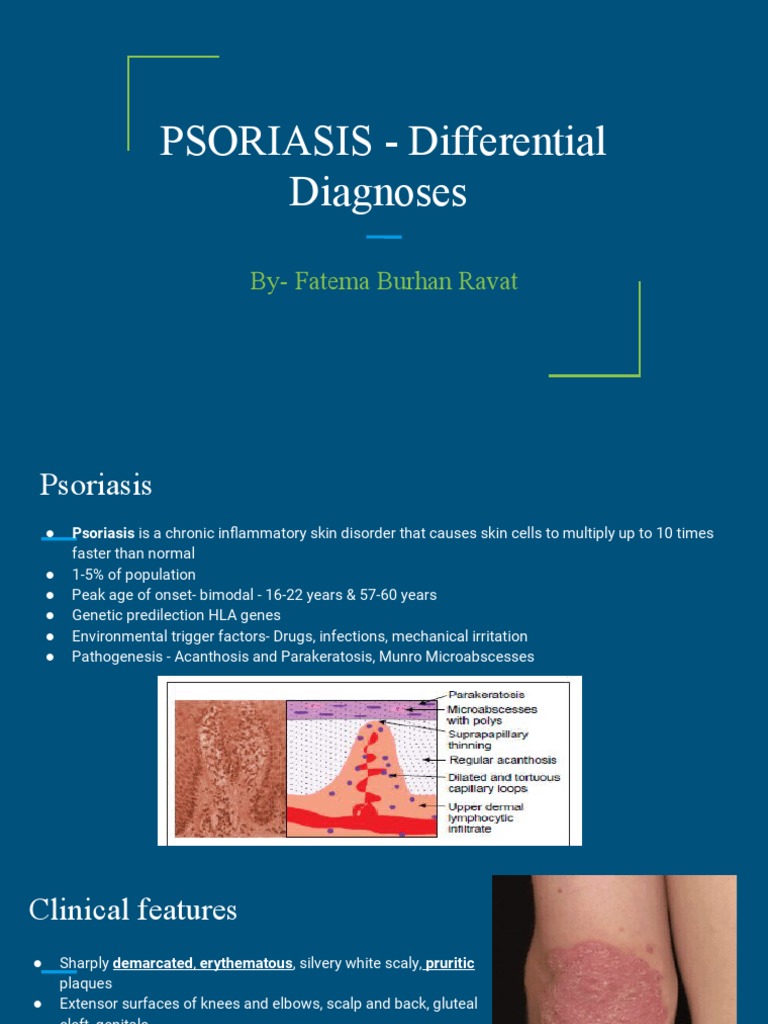 PSORIASIS - Differential Diagnoses | PDF