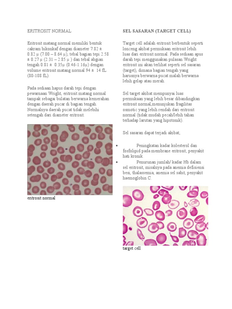 Eritrosit Normal | PDF