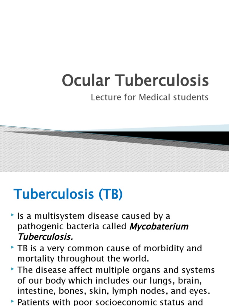 Ocular Tuberculosis | PDF | Tuberculosis | Medical Specialties