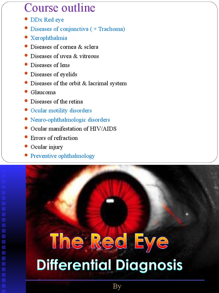 The Red Eye | PDF | Cornea | Human Eye