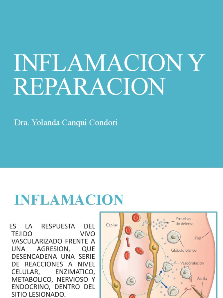 Capitulo 3 Inflamación Aguda y Reparación | PDF | Inflamación | Inmunología