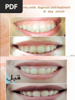 Gingival Stillmans Cleft - Revisited | PDF | Periodontology | Mouth