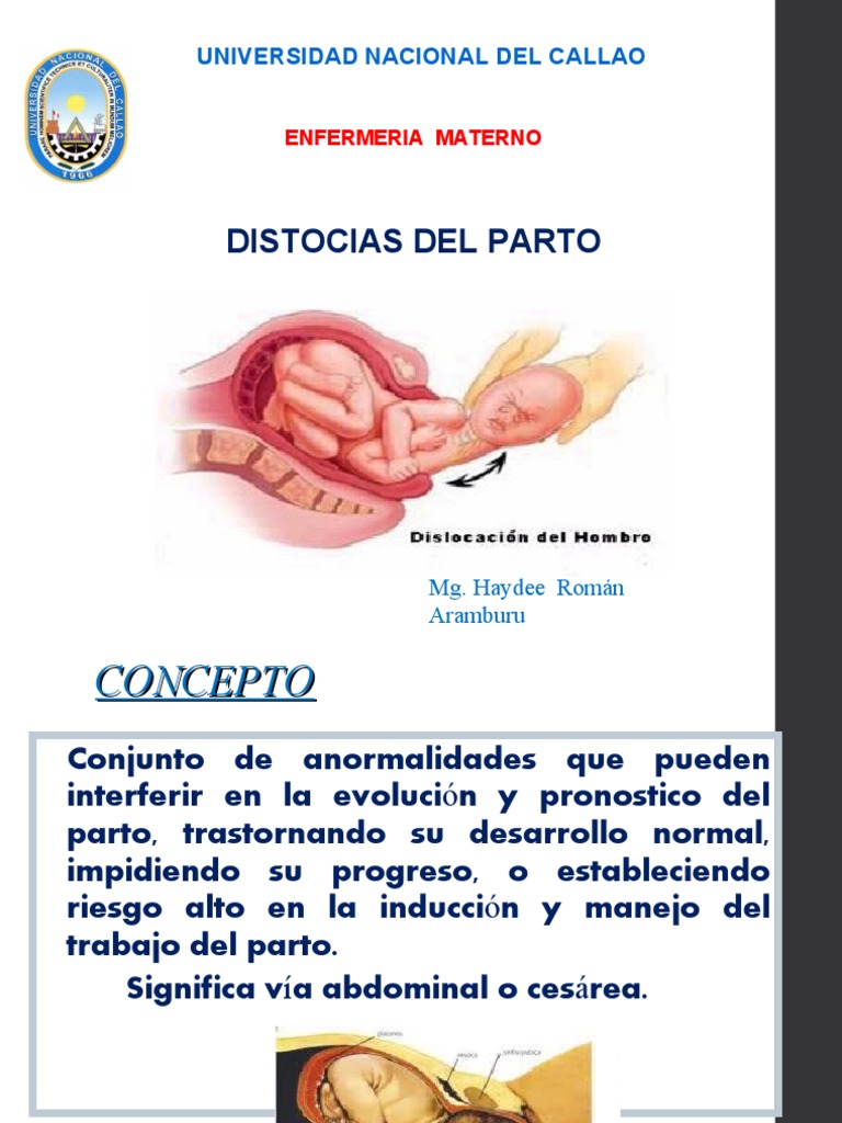 DISTOCIA | PDF | Parto | Vagina