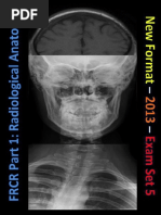 ACR BI-RADS® Atlas Fifth Edition | PDF | Mammography | Clinical Medicine