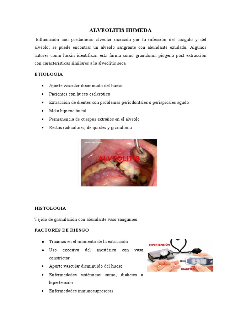 Alveolitis Humeda | PDF