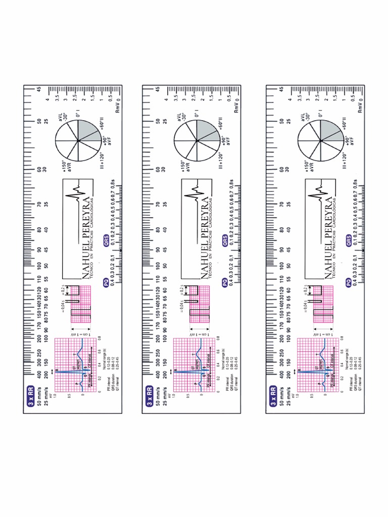 Regla Ecg Corregida | PDF