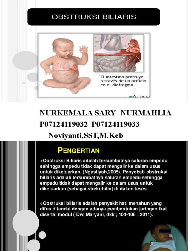 Ppt. Neonatus (Ob) | PDF