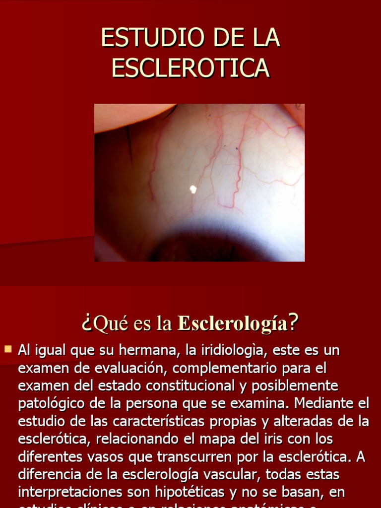 Estudio de La Esclerotica | PDF | Sistema circulatorio | Angiología