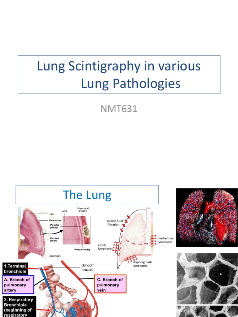 Lung Scintigraphy in Various Lung Pathologies | PDF | Pneumonia | Lung
