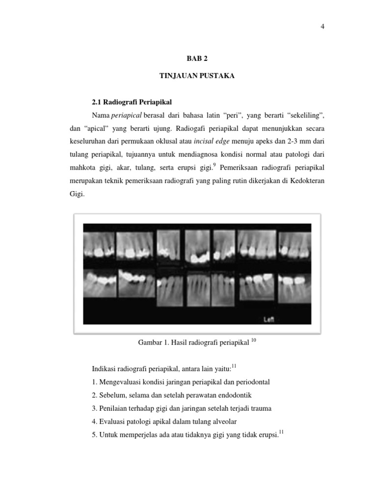 Radiografi Periapikal | PDF