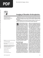 Modified Axillary Shoulder Radiograph | PDF | Shoulder | Human Anatomy