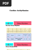 EKG Rhythms | PDF | Artificial Cardiac Pacemaker | Cardiopulmonary ...