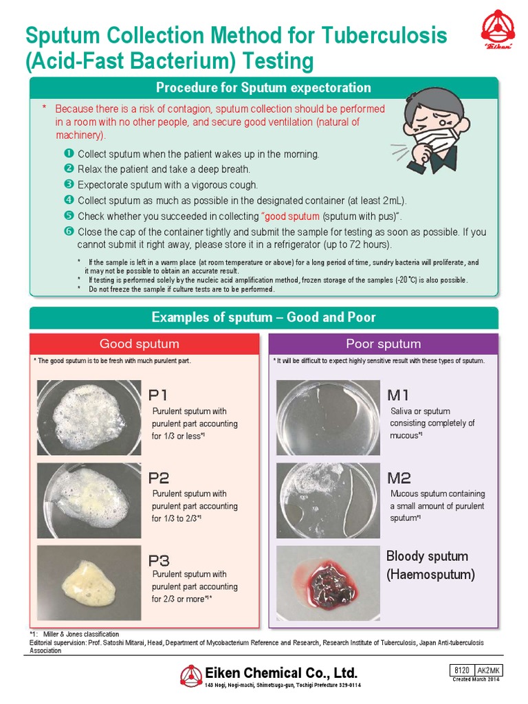 How To Take Sputum Suitable For TB - Inspection | PDF | Respiratory ...