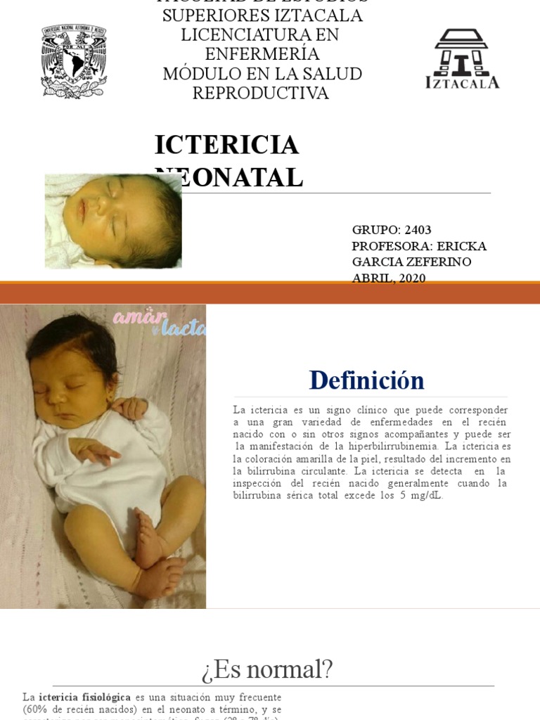 Ictericia Neonatal | PDF | Enfermedades y trastornos | Especialidades Medicas