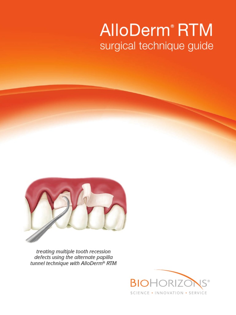 Alloderm Surgical Technique Guide PDF | PDF | Periodontology | Dental ...