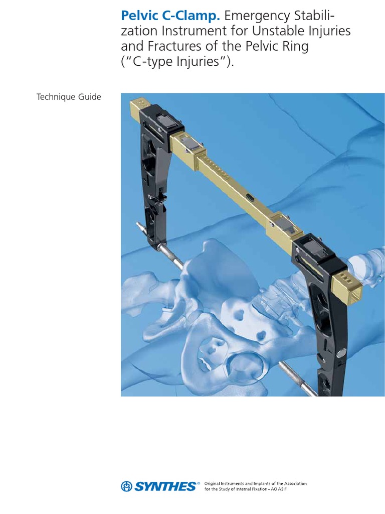 Pelvic - C-Clamp Usage | PDF | Pelvis | Musculoskeletal System