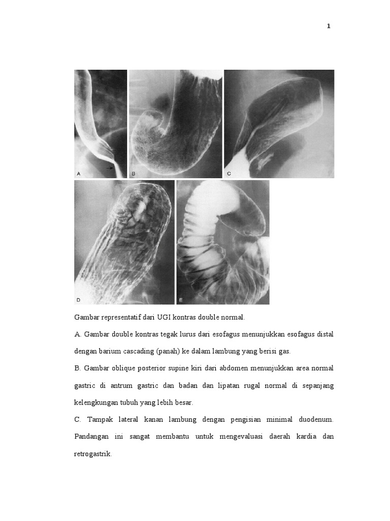 Radioanatomi UGI HPS | PDF