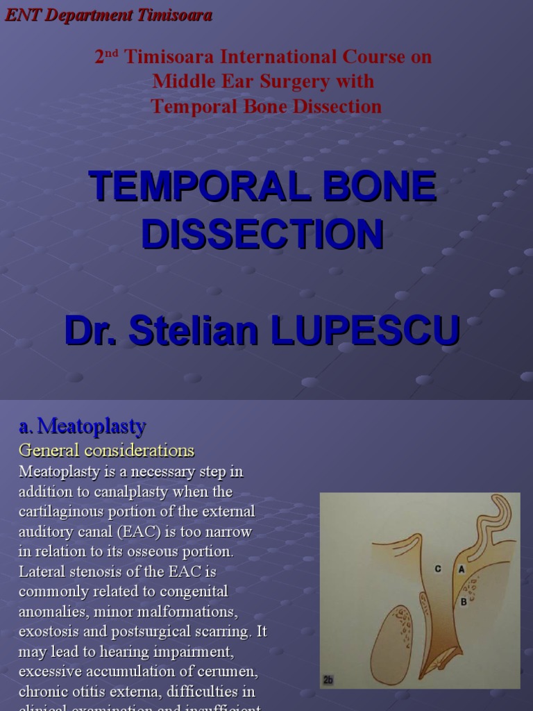 Temporal Bone Dissection Dr. Stelian LUPESCU | PDF | Ear | Anatomical ...