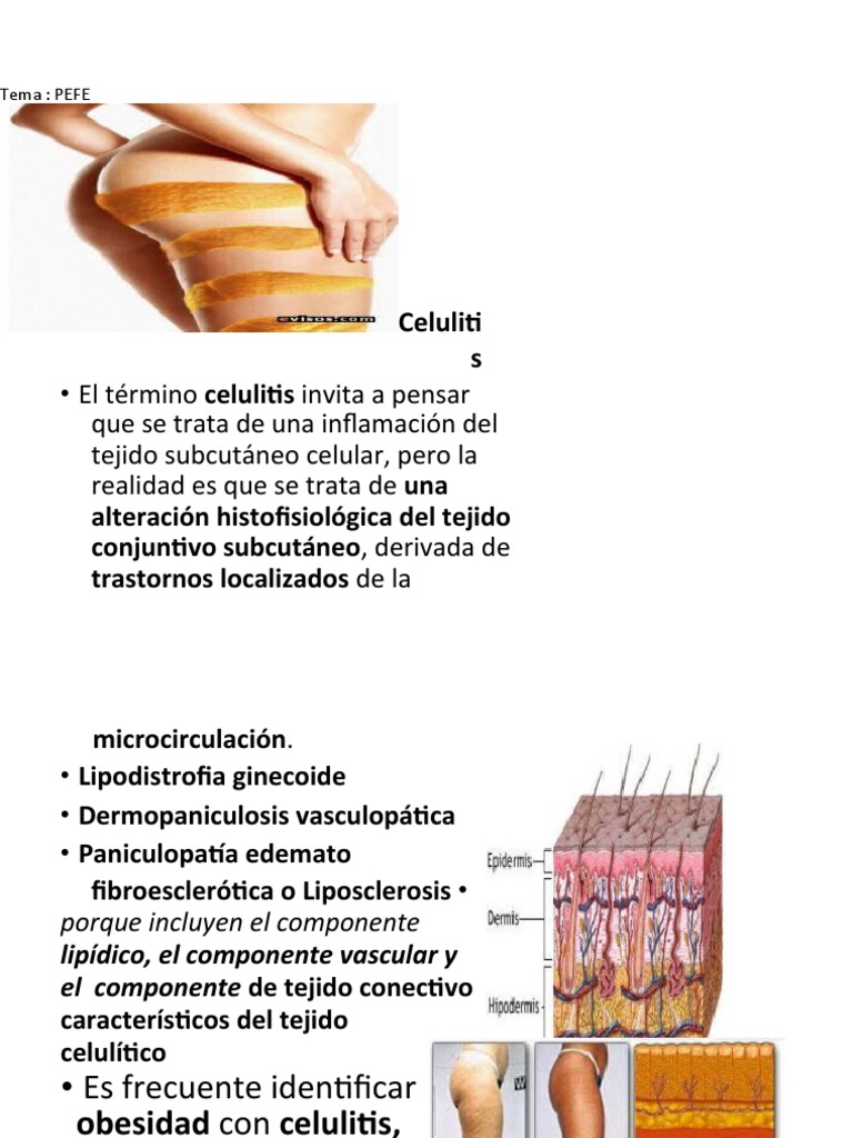 CELULITIS | PDF | Dieta | Obesidad