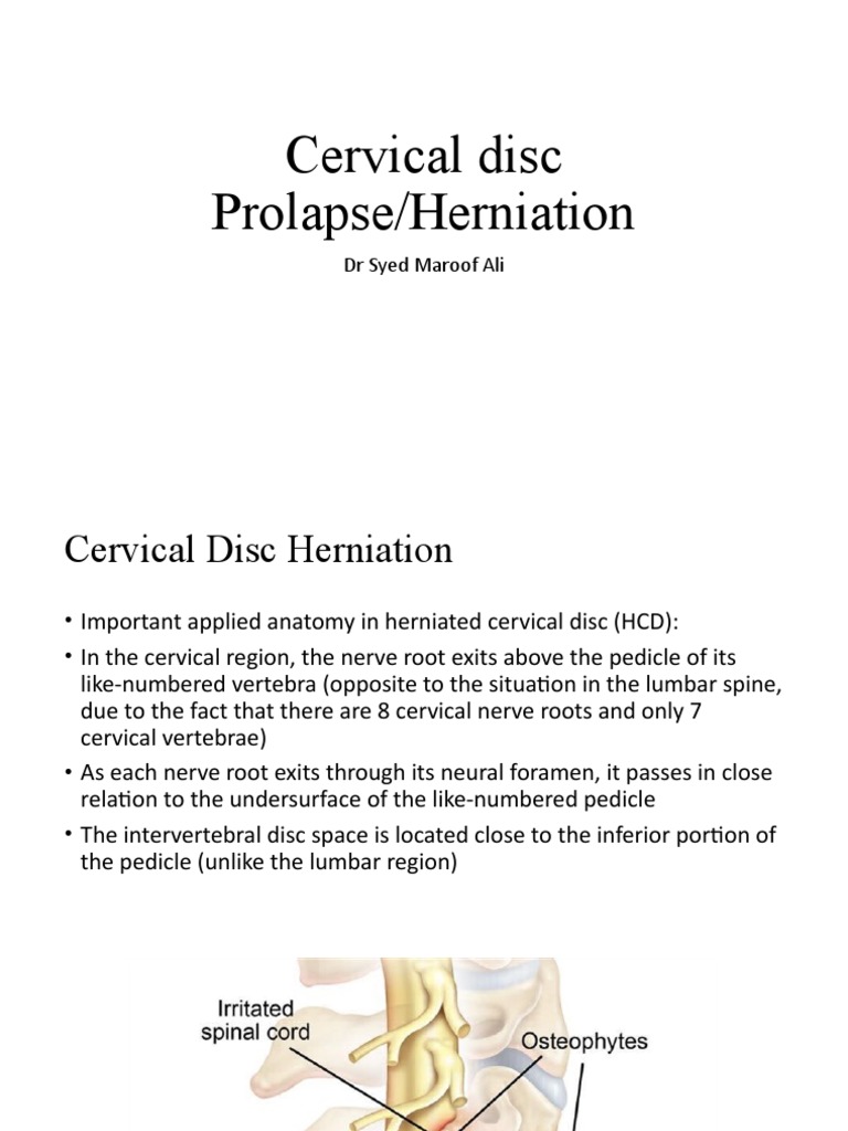 Cervical Disc Herniation Overview | PDF | Vertebra | Shoulder
