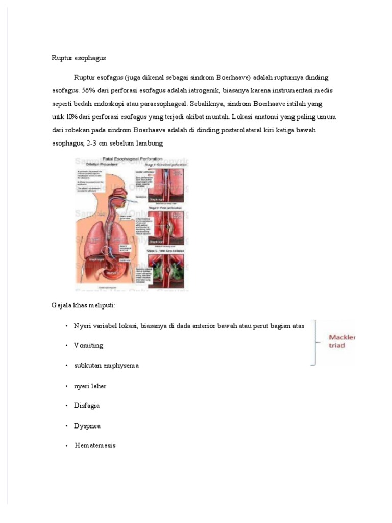 PDF Ruptur Esophagus | PDF