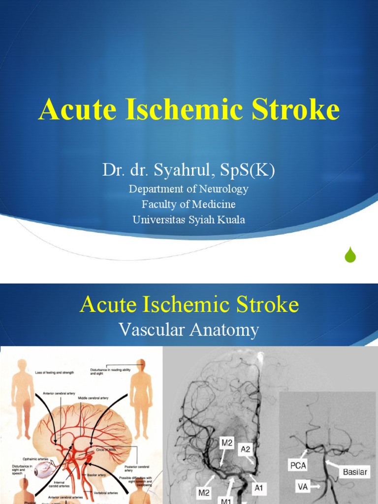 Stroke Iskemik (Dr. Dr. Syahrul, SPS (K) ) | PDF | Stroke | Ischemia