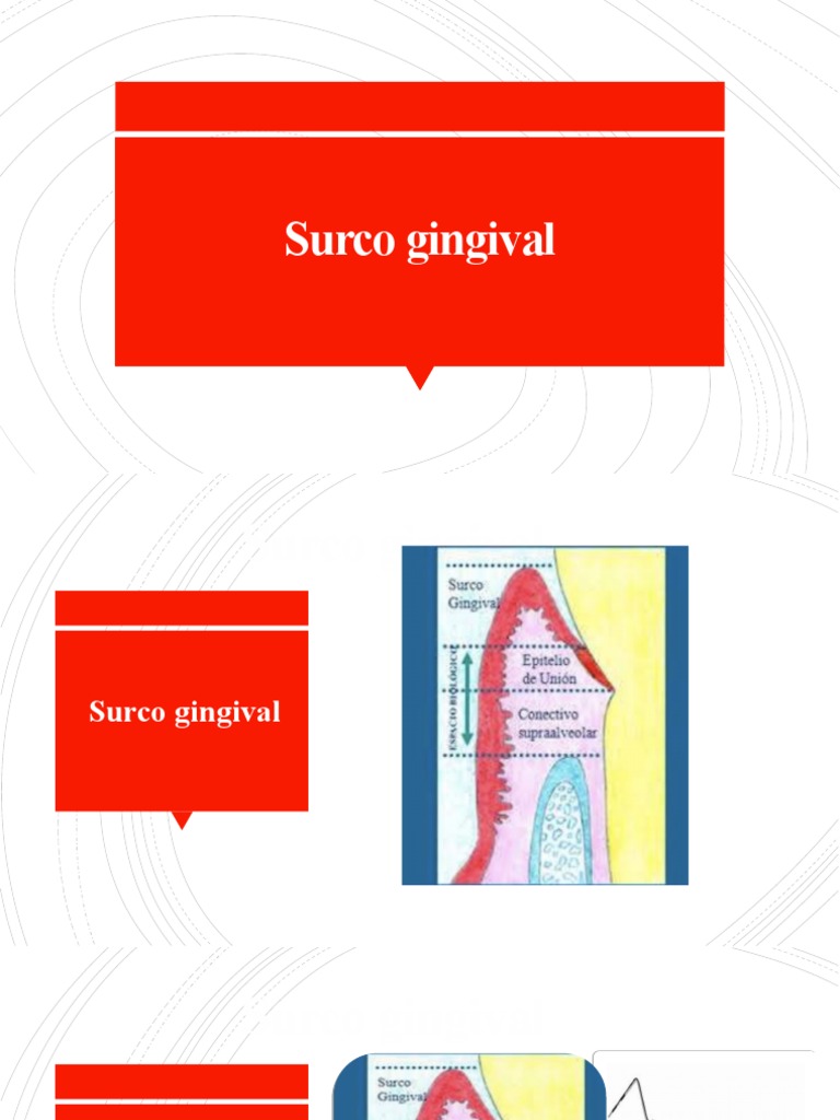 Video Surco Gingival | PDF